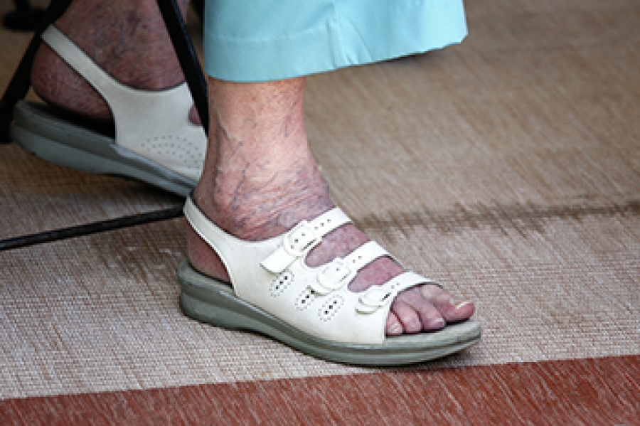 Common Causes of Foot Pain Among Elderly People